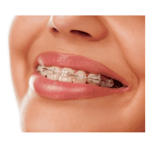 Gum Cyst | Mucocele Early Detection With Oralens - Oralens